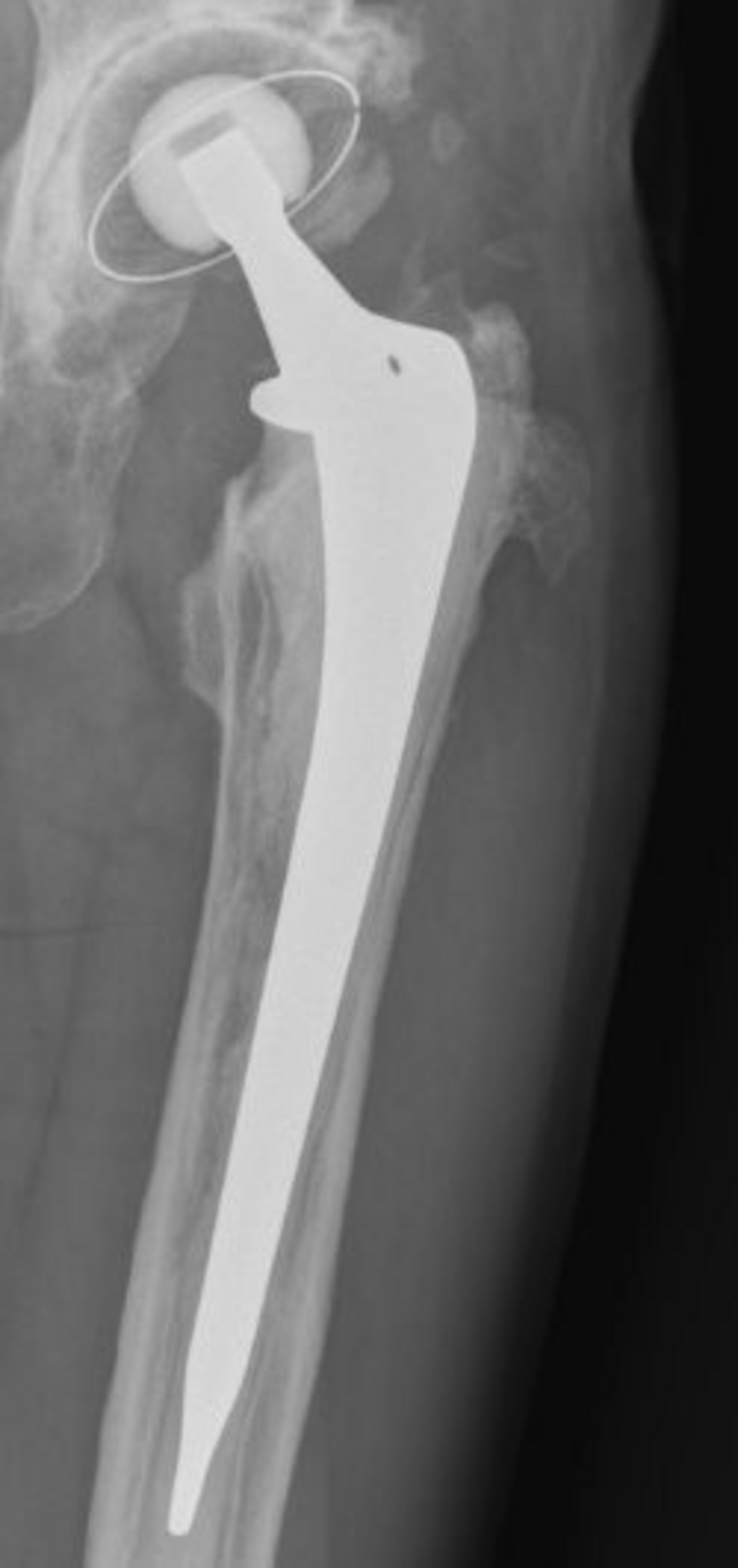 Hüfte und Oberschenkel – Dietrich-Bonhoeffer-Klinikum